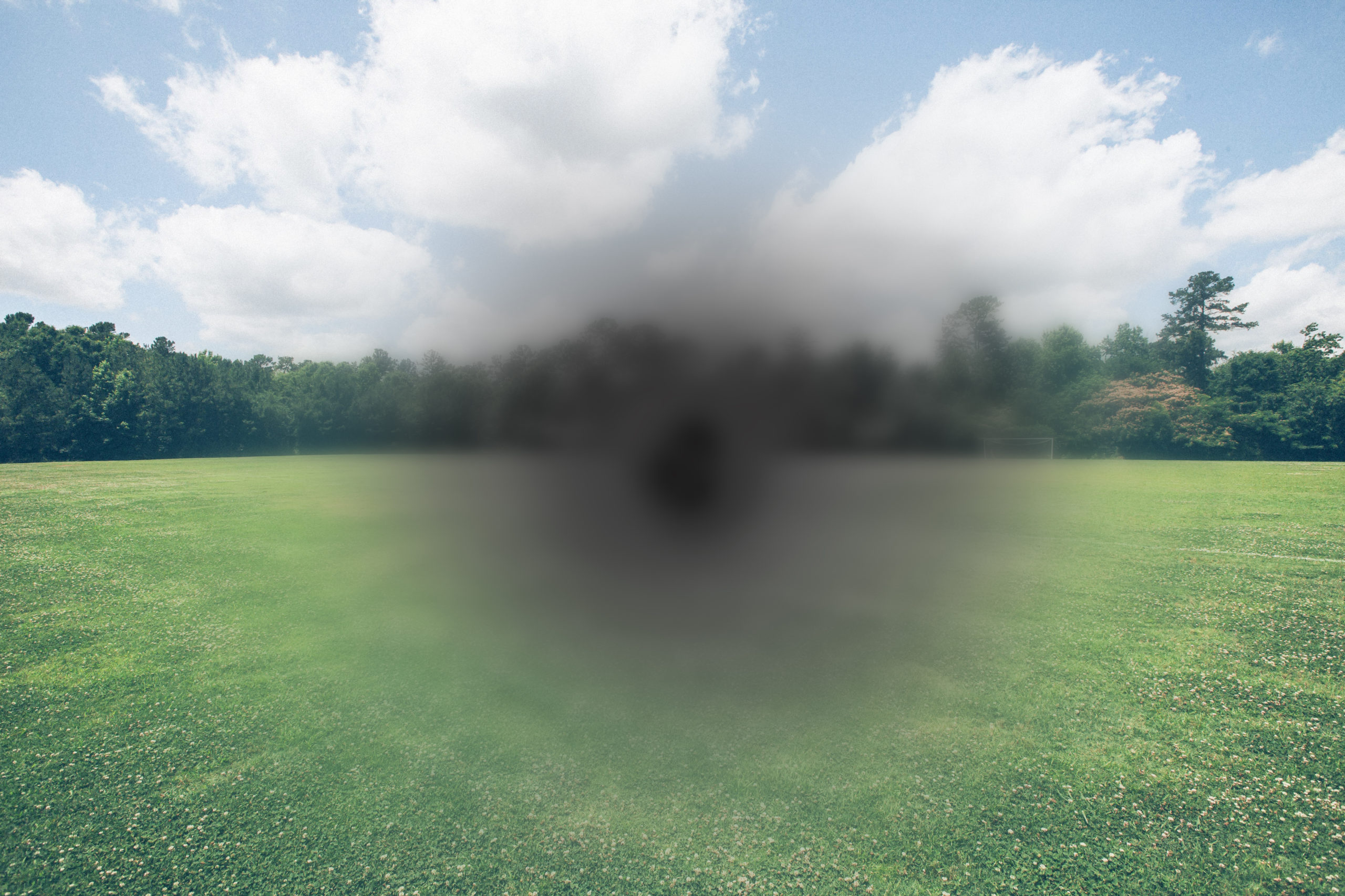 Age Related Macular Degeneration ARMD We Fix Eyes Age Related Macular Degeneration ARMD We Fix Eyes