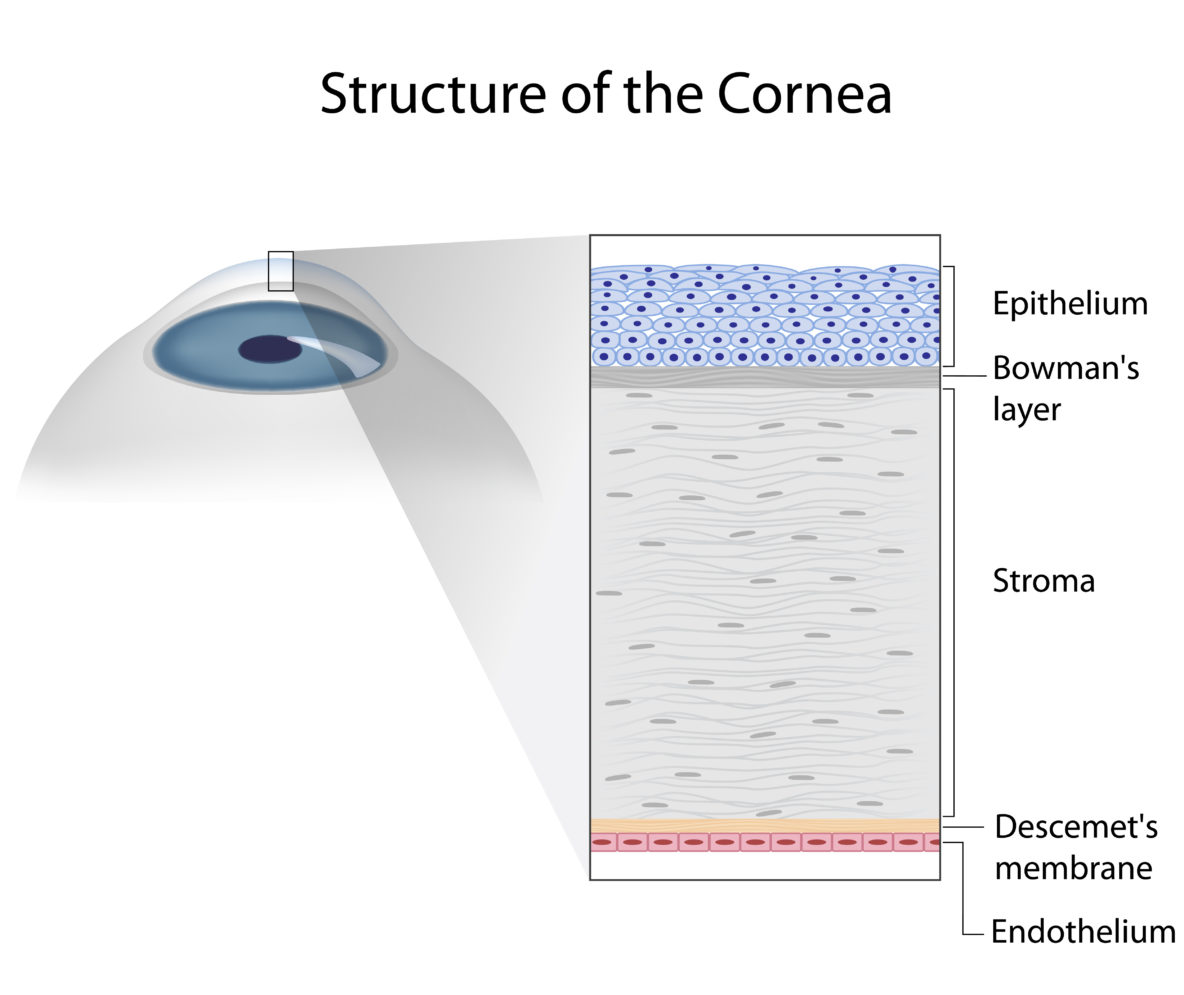Corneal Graft - Seeing Through Another's Eye - We Fix Eyes