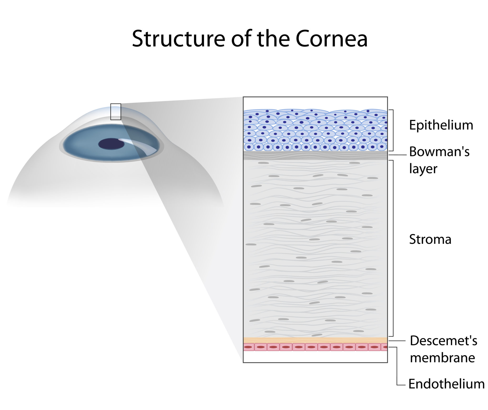 Corneal Graft - Seeing Through Another's Eye - We Fix Eyes