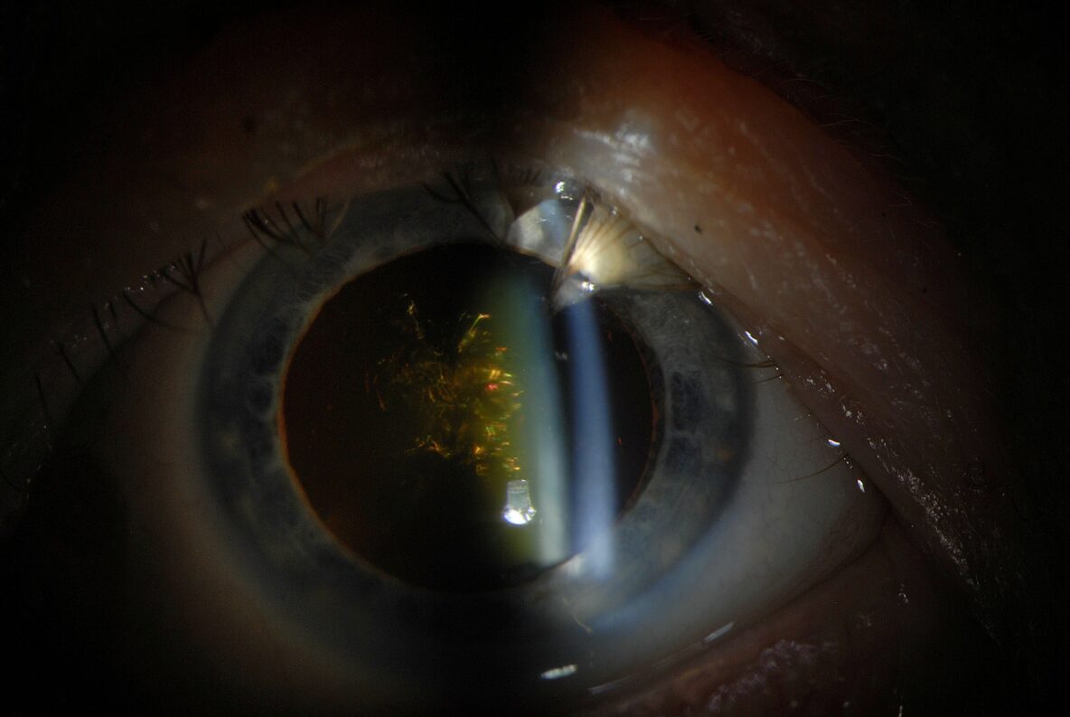 Festive Season and Your Eyes - We Fix Eyes